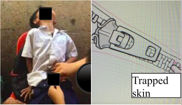 ‘Bebird’ Anak Murid Tersepit Zip Seluar, Apa Cikgu Kena Buat? Ini Cara ... ‘Bebird’ Anak Murid Tersepit Zip Seluar, Apa Cikgu Kena Buat? Ini Cara ...